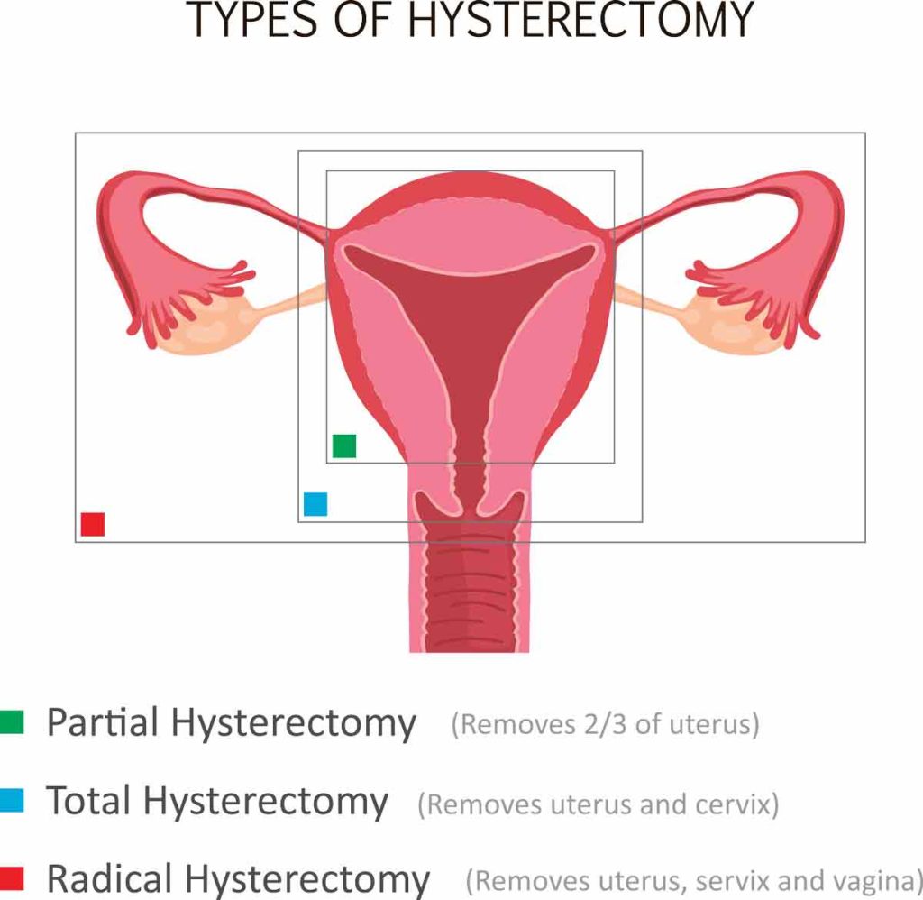 Ask Dr John Esq What Is A Retained Placenta Diller Law Personal